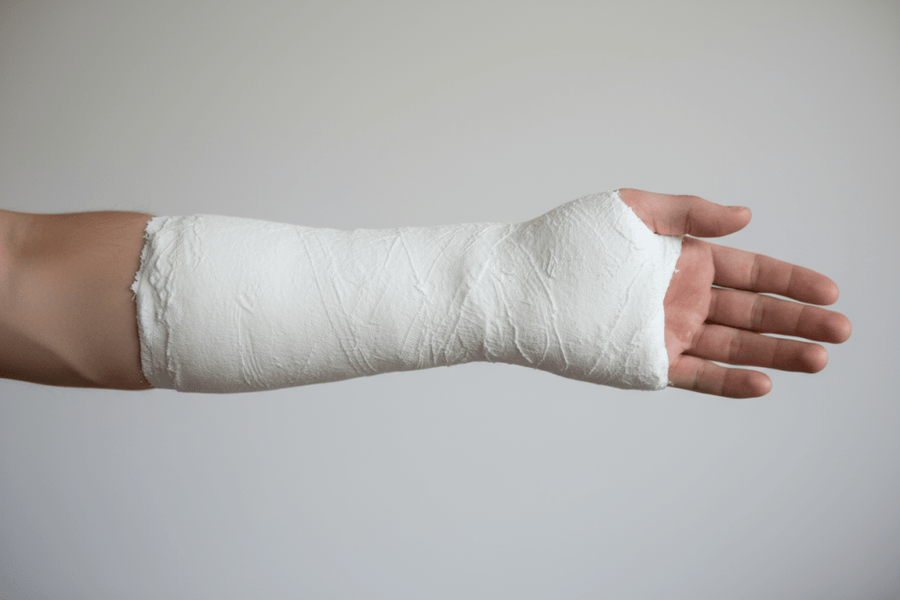 Heal Your Broken Forearm Fast (Rehab Tips That Work)